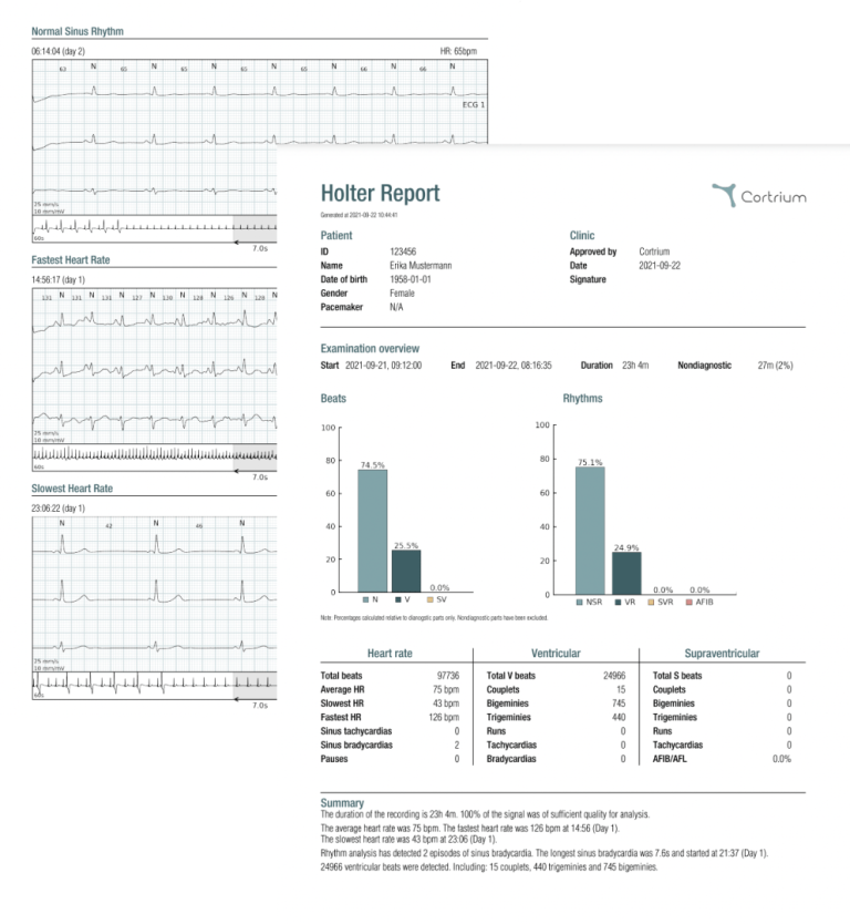 Product – Cortrium