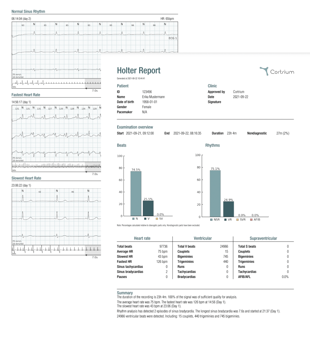Product – Cortrium